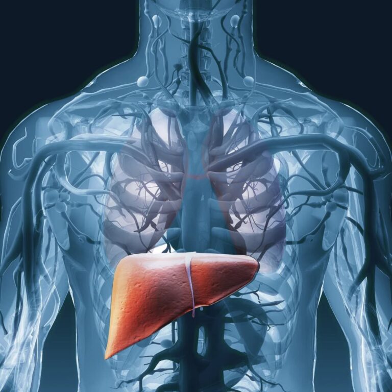 T2D and Non-Alcoholic Fatty Liver Disease (NAFLD) - Texas Diabetes ...